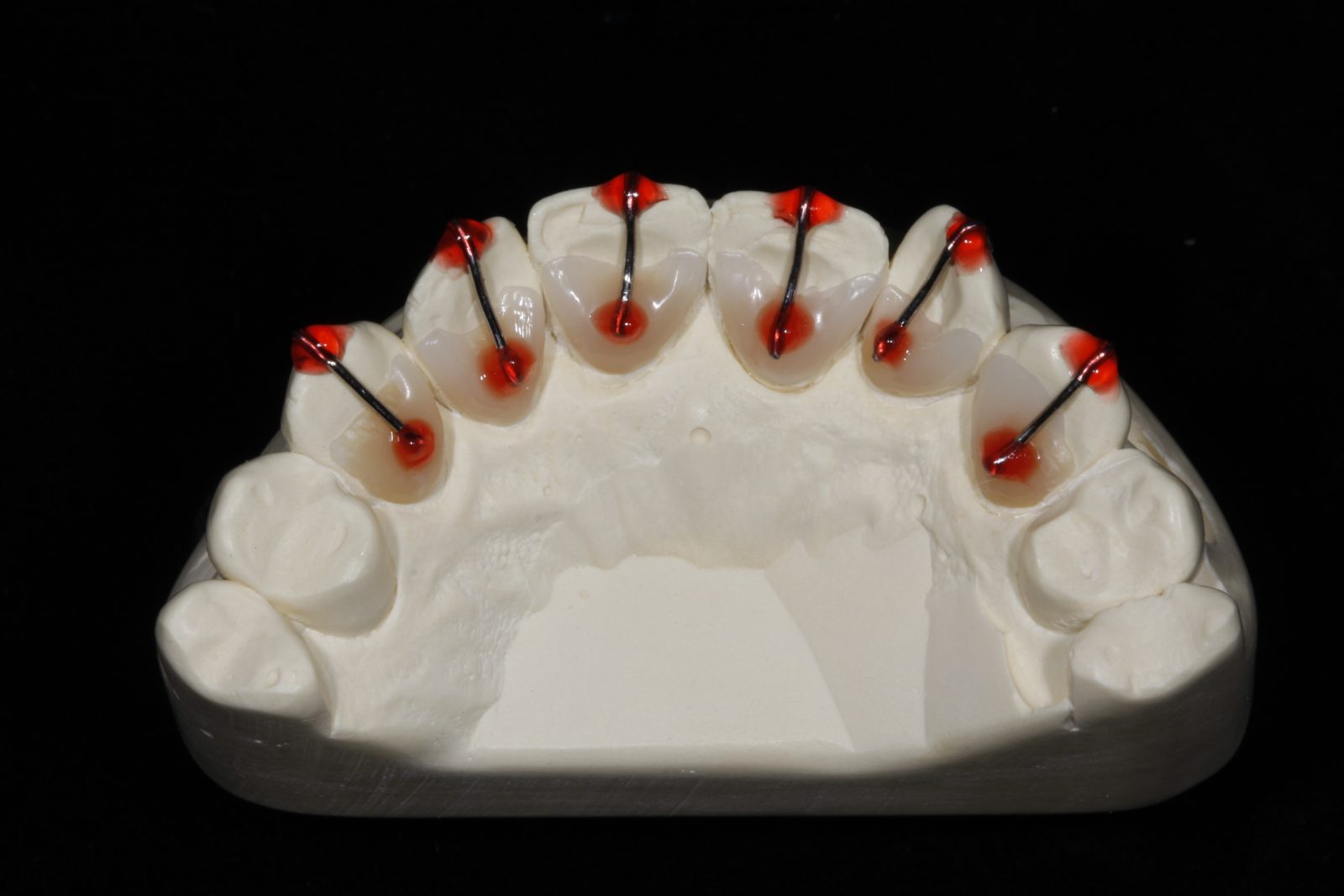 Galerie – Zahntechnisches Laboratorium Harald Göbel GmbH