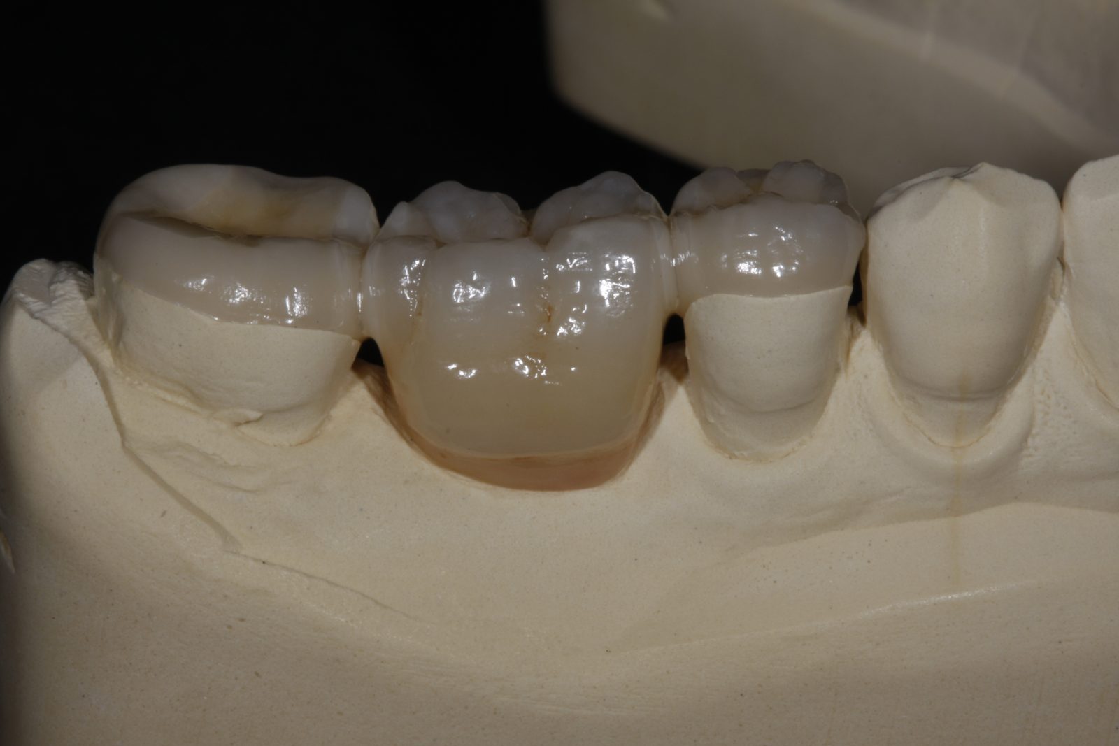 Galerie – Zahntechnisches Laboratorium Harald Göbel GmbH