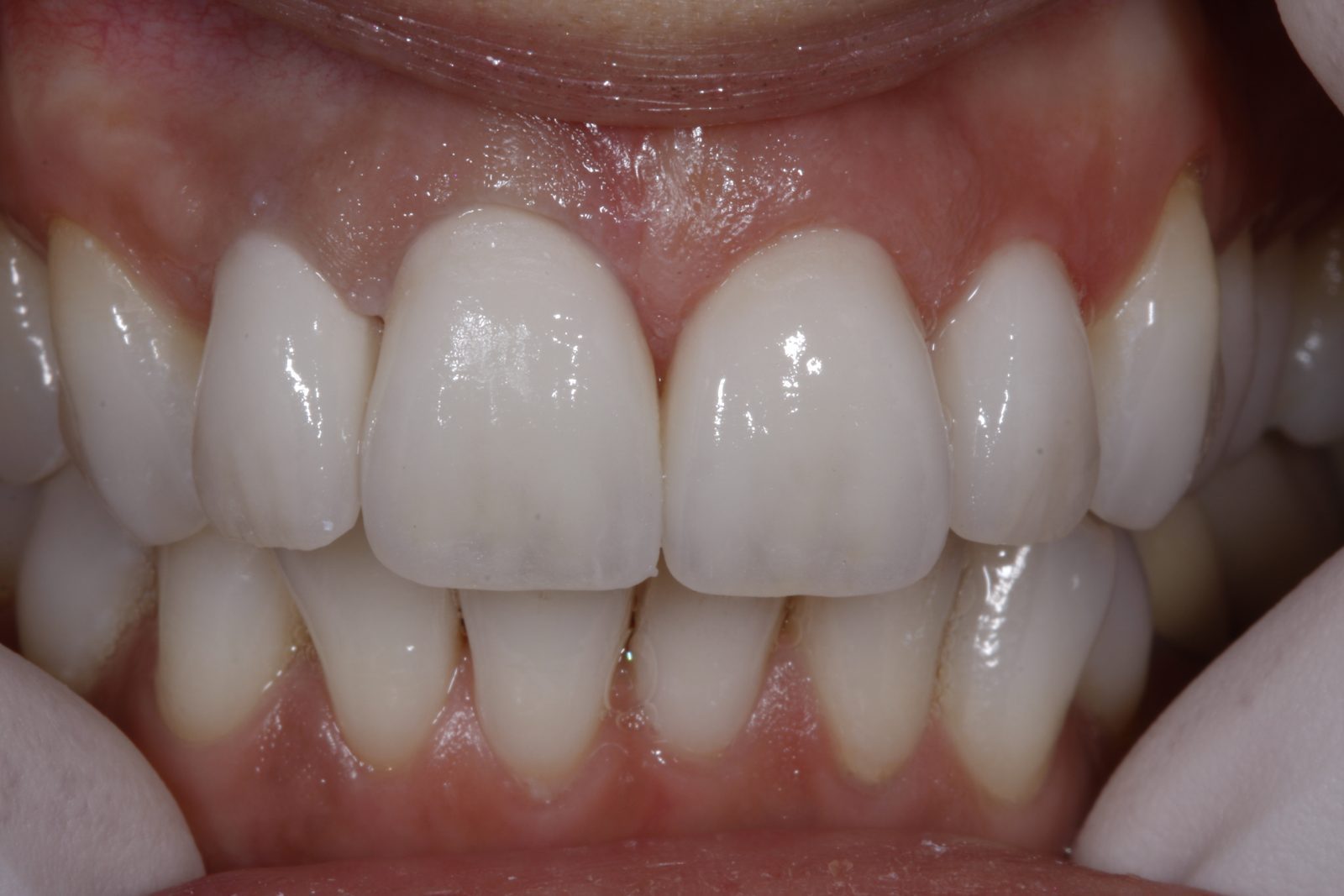 Galerie – Zahntechnisches Laboratorium Harald Göbel GmbH