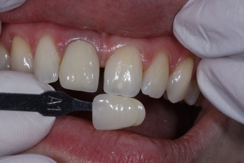 Galerie – Zahntechnisches Laboratorium Harald Göbel GmbH