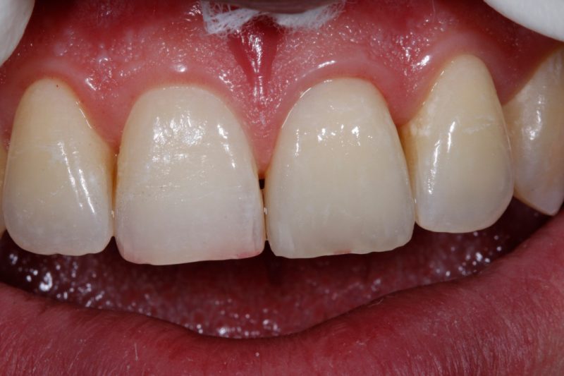 Galerie – Zahntechnisches Laboratorium Harald Göbel GmbH